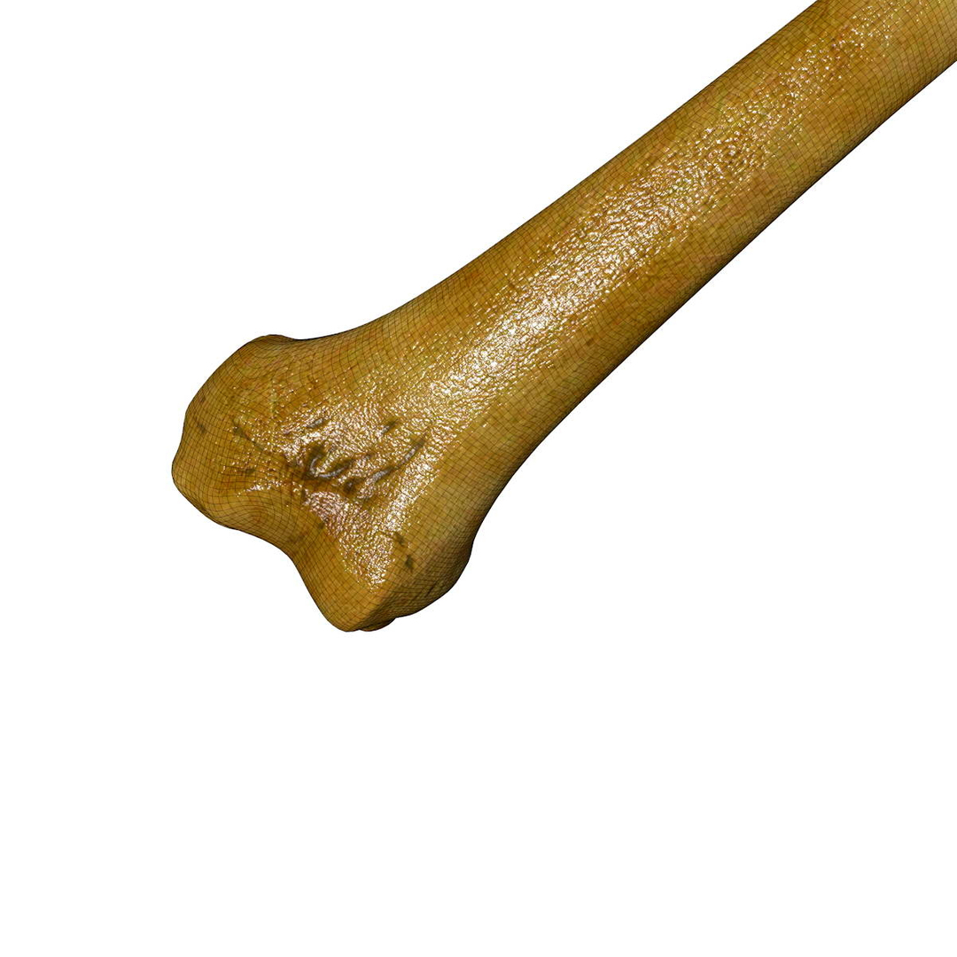 Human Thigh Bone Femur C4d