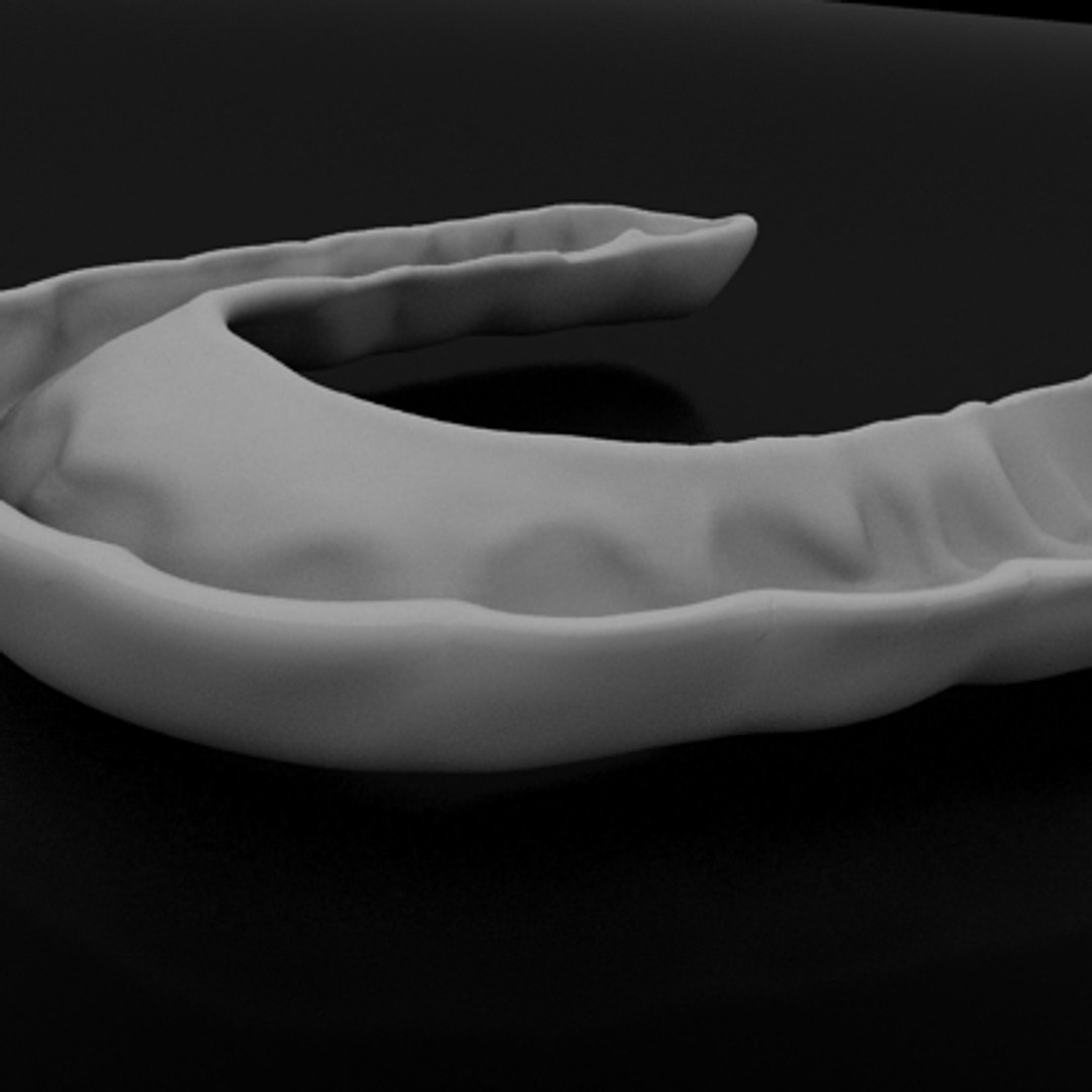 Bite Splint 3d Model