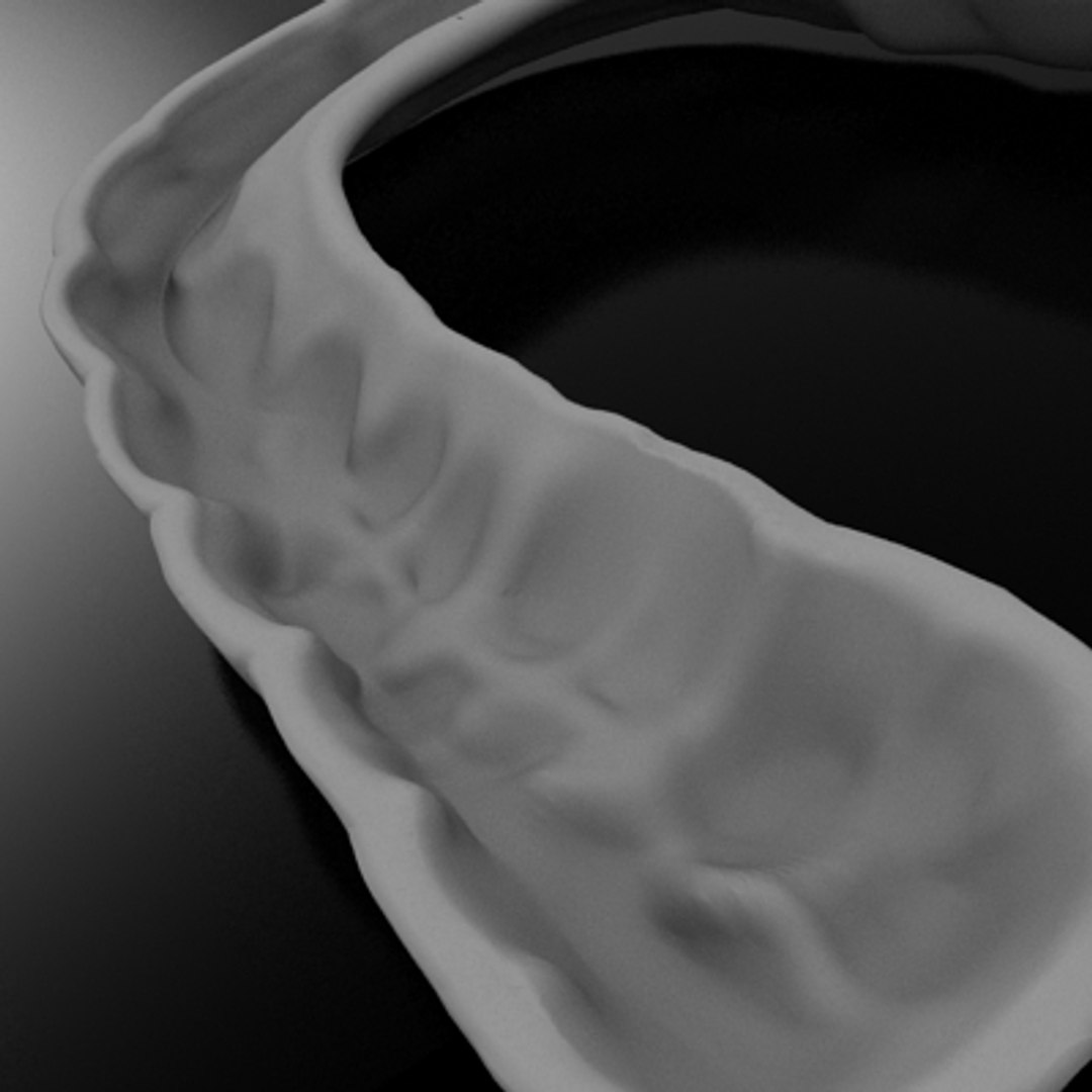 Bite Splint 3d Model
