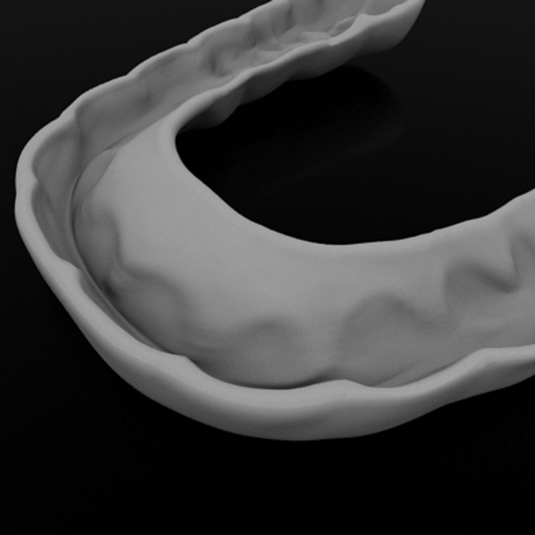 Bite Splint 3d Model