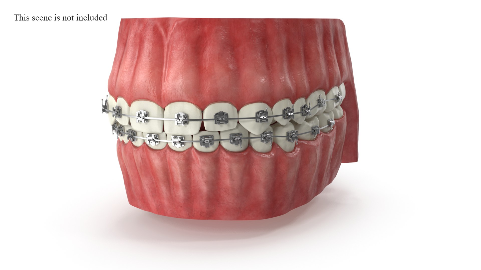 Human Permanent Dentition With Self Ligating Steel Dental Braces V01 3D ...