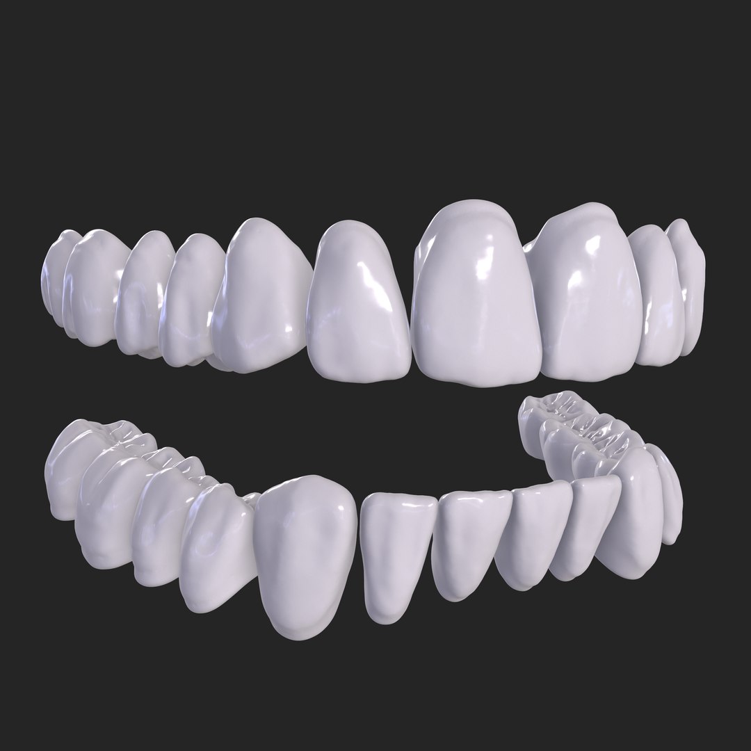 Dental Anatomy Model Real Medical Case 3D - TurboSquid 2048082