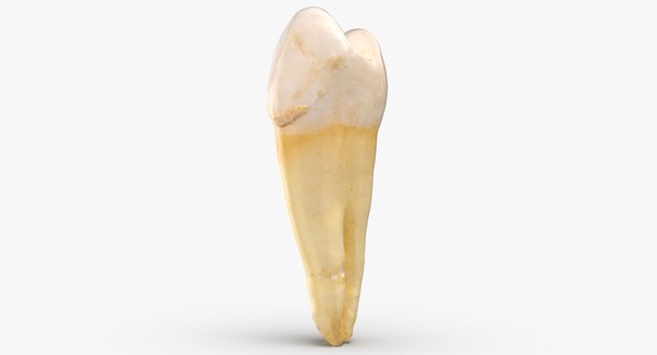 3D model Human Upper Jaw Premolars Teeth Clean and Damaged Collection ...