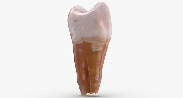 3D model Human Upper Jaw Premolars Teeth Clean and Damaged Collection - 6 models - TurboSquid ...