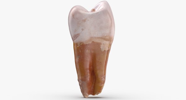 3D model Human Upper Jaw Premolars Teeth Clean and Damaged Collection ...