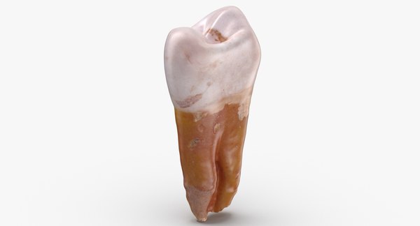 3D model Human Upper Jaw Premolars Teeth Clean and Damaged Collection - 6 models - TurboSquid ...