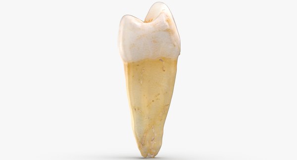 3D model Human Upper Jaw Premolars Teeth Clean and Damaged Collection ...