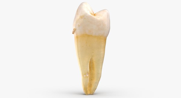 3D model Human Upper Jaw Premolars Teeth Clean and Damaged Collection ...