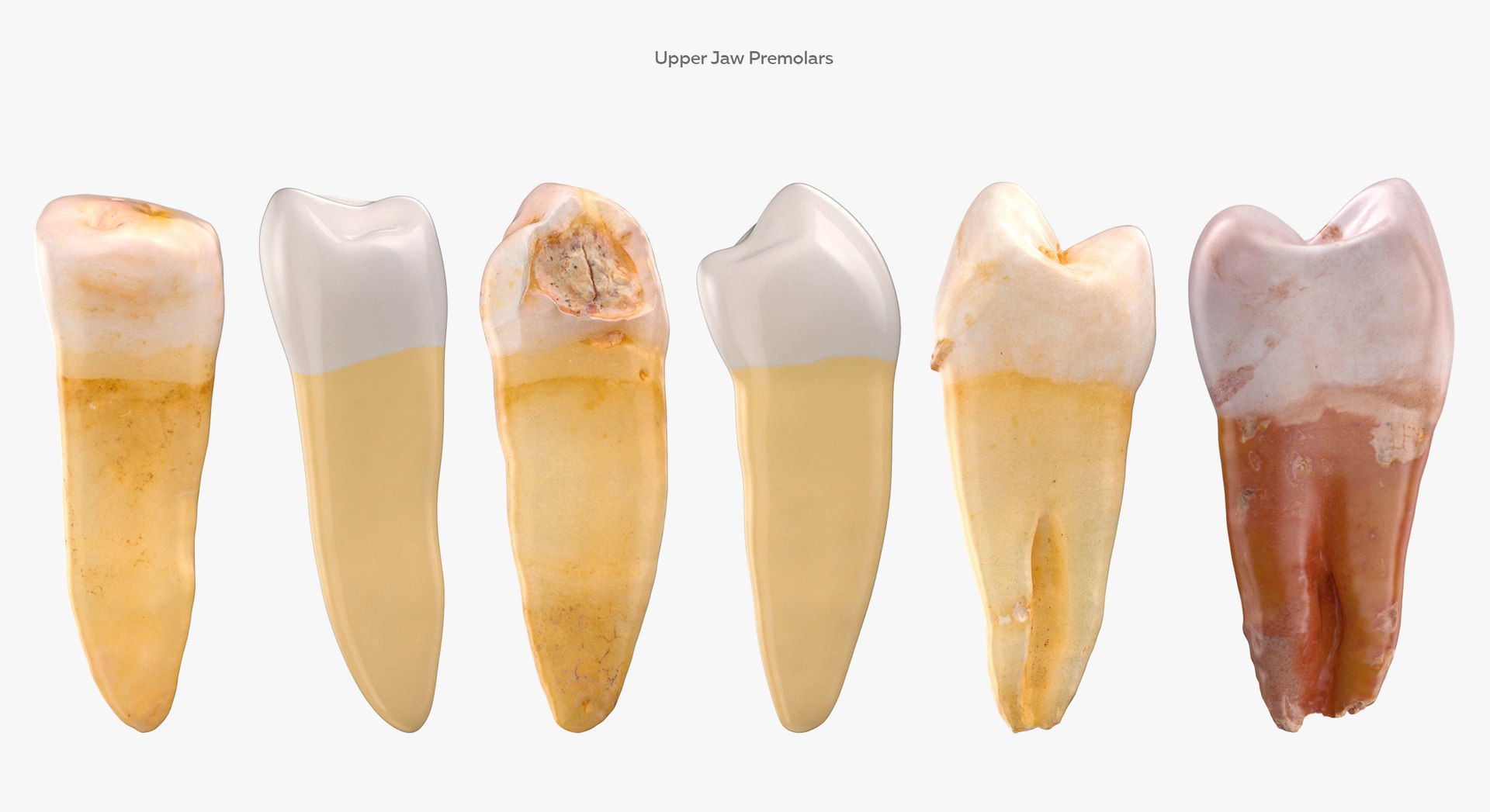 3D model Human Upper Jaw Premolars Teeth Clean and Damaged Collection ...
