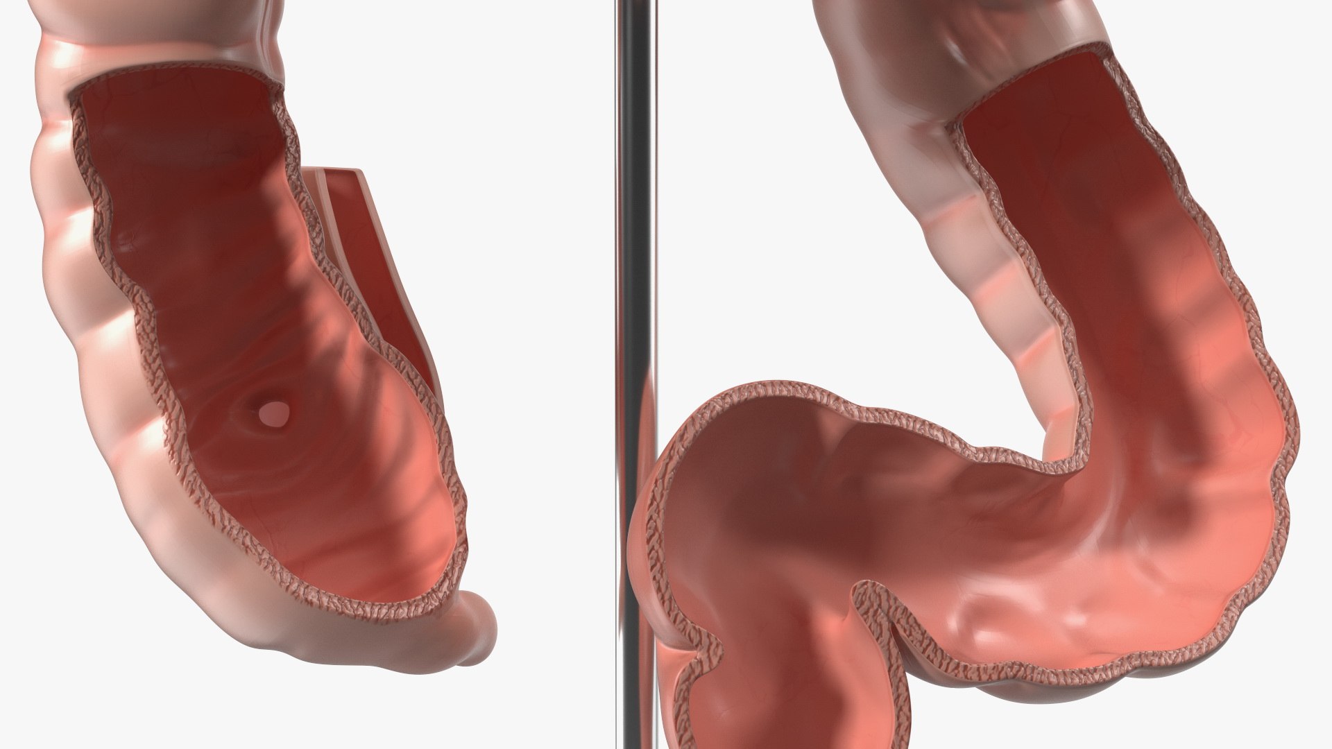 Intestine Medical Model 3D - TurboSquid 2068869