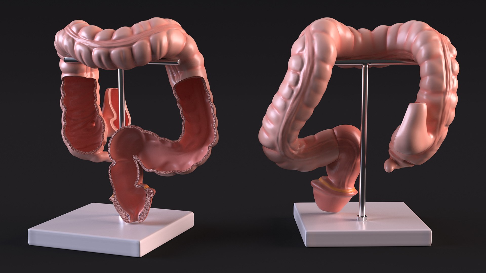 Intestine Medical Model 3D - TurboSquid 2068869