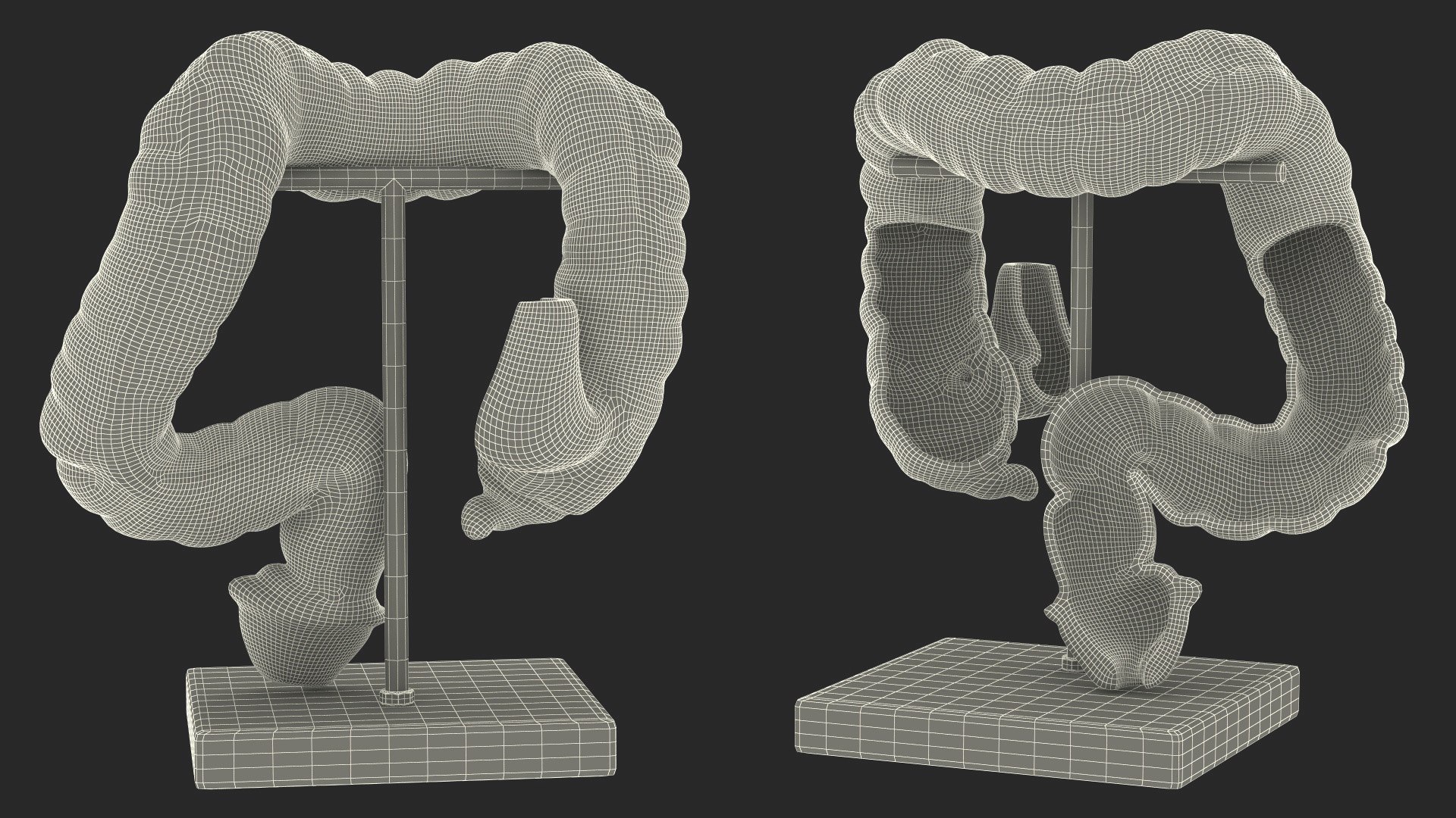 Intestine Medical Model 3D - TurboSquid 2068869