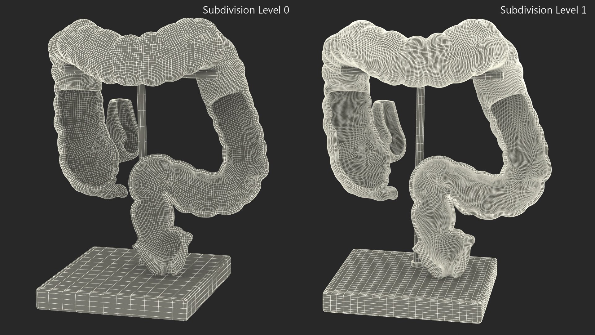 Intestine Medical Model 3D - TurboSquid 2068869