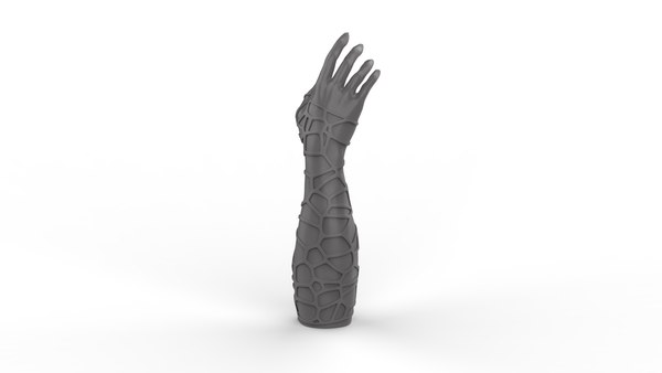 3D-Printed Orthopedic Arm 3D model - TurboSquid 2011716