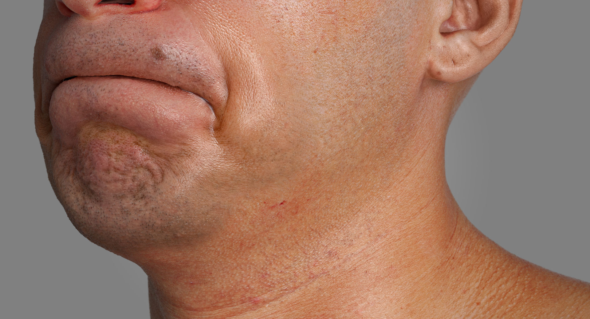 Real PBR Marcus Human Head Cheek Puff AU34 3D - TurboSquid 1741082