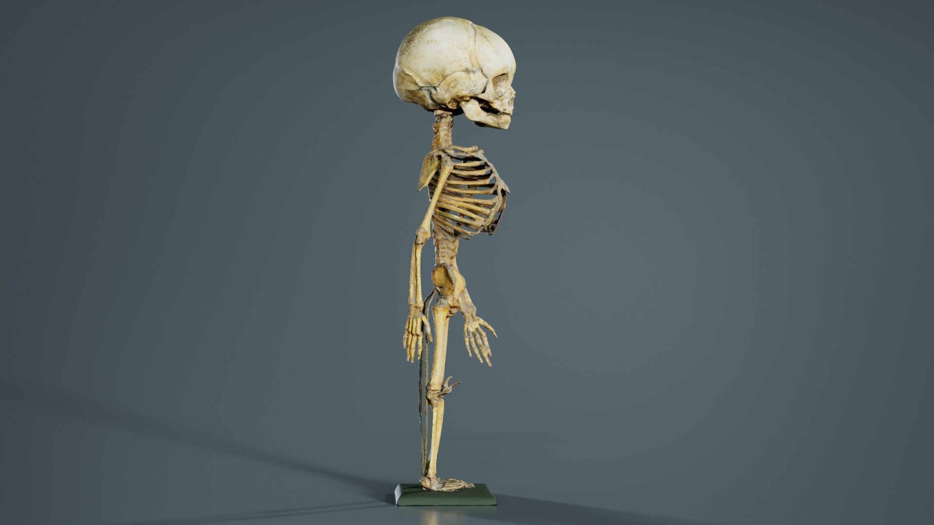 Unborn Human Baby Skeleton Remastered 3D - TurboSquid 2359849