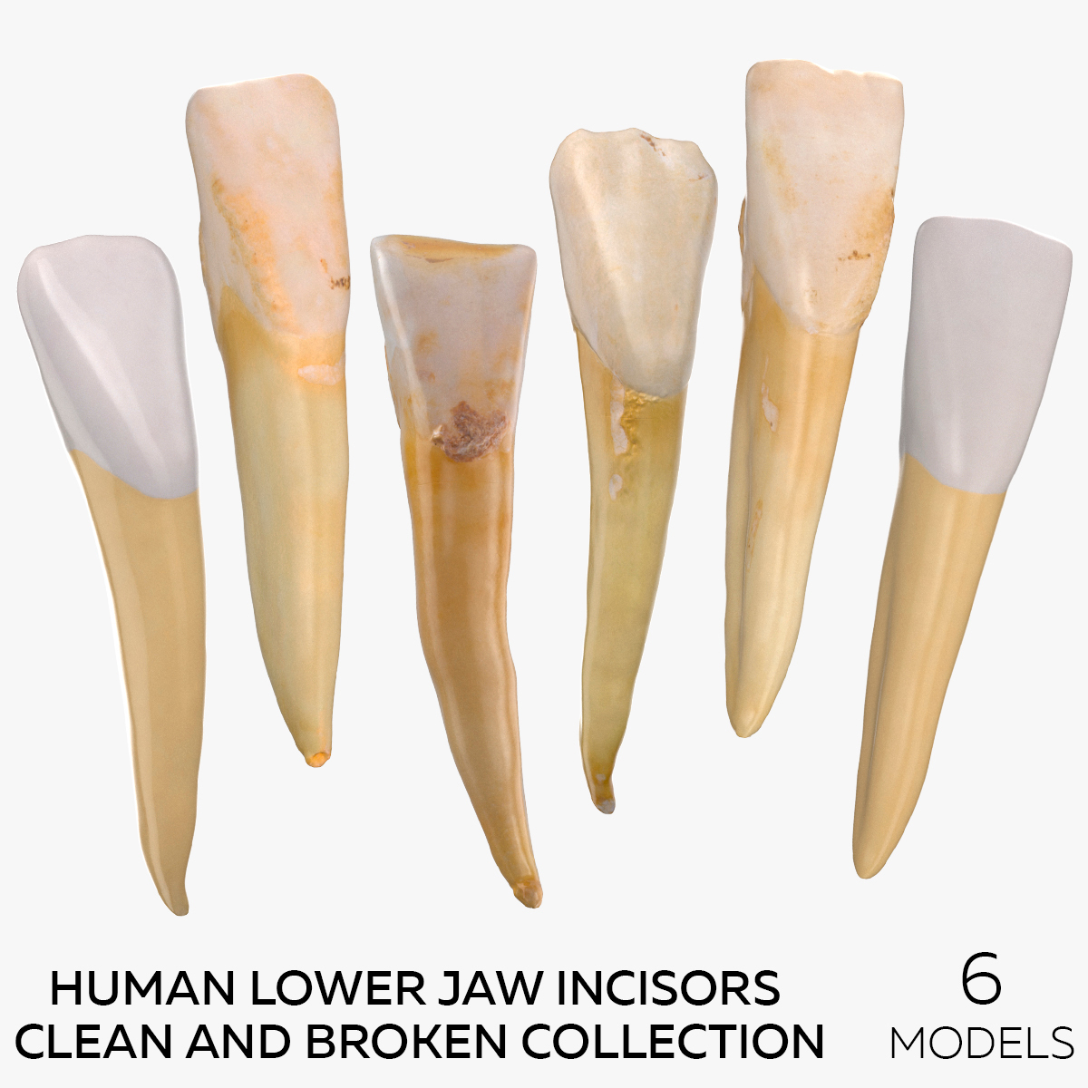 3D model Human Lower Jaw Incisors Clean and Broken Collection - 6 ...