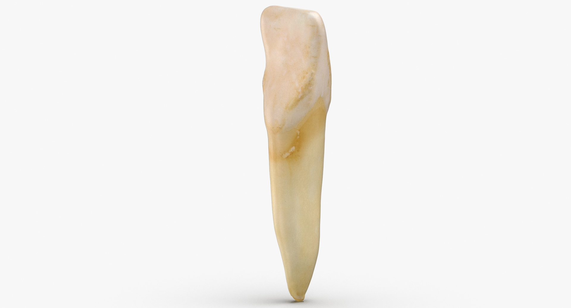 3D model Human Lower Jaw Incisors Clean and Broken Collection - 6 ...