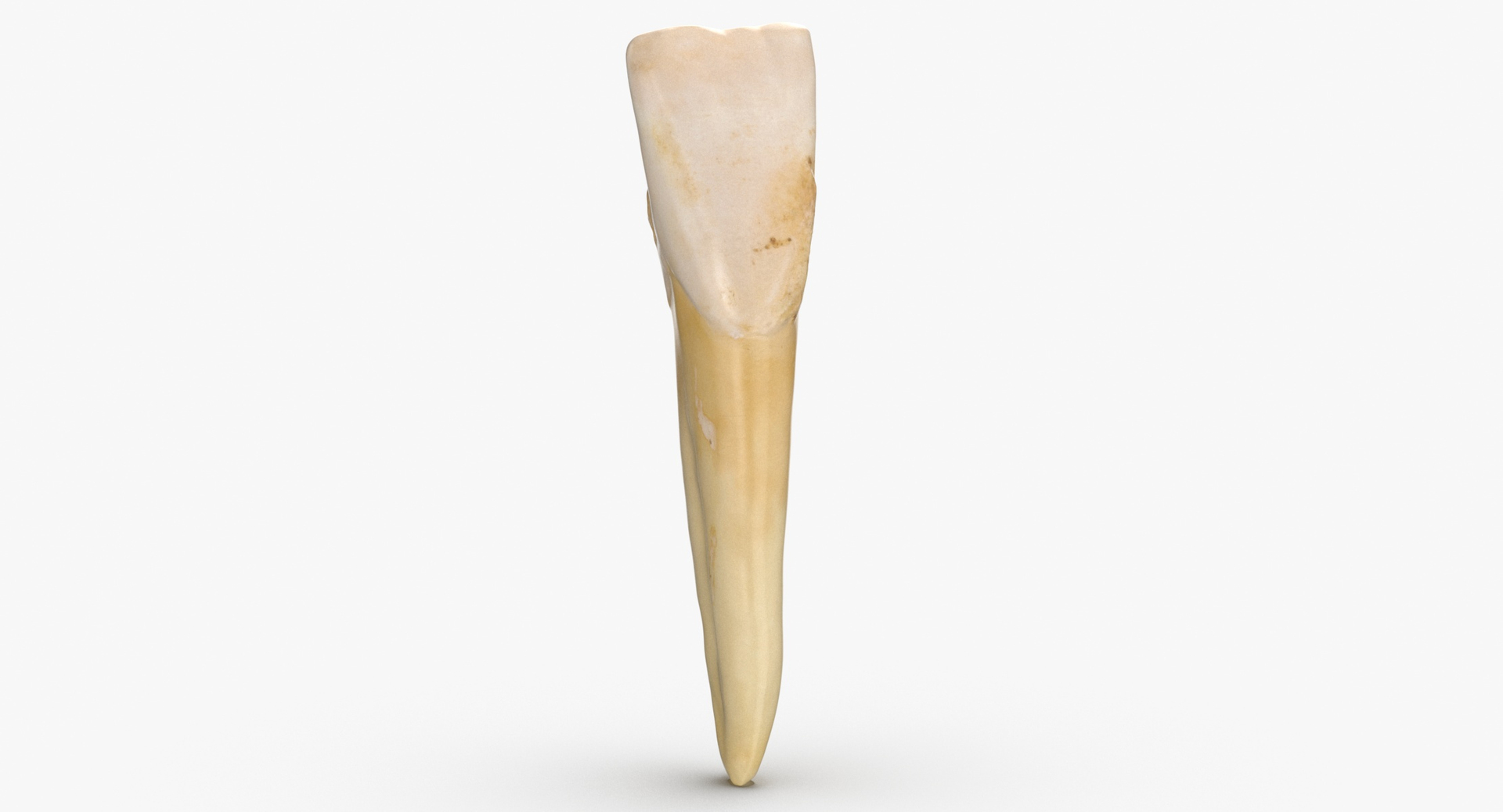 3D model Human Lower Jaw Incisors Clean and Broken Collection - 6 ...