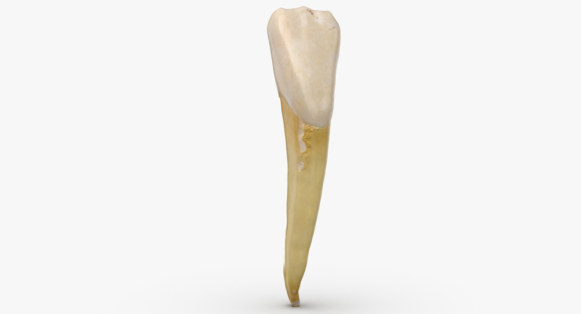 3D model Human Lower Jaw Incisors Clean and Broken Collection - 6 ...