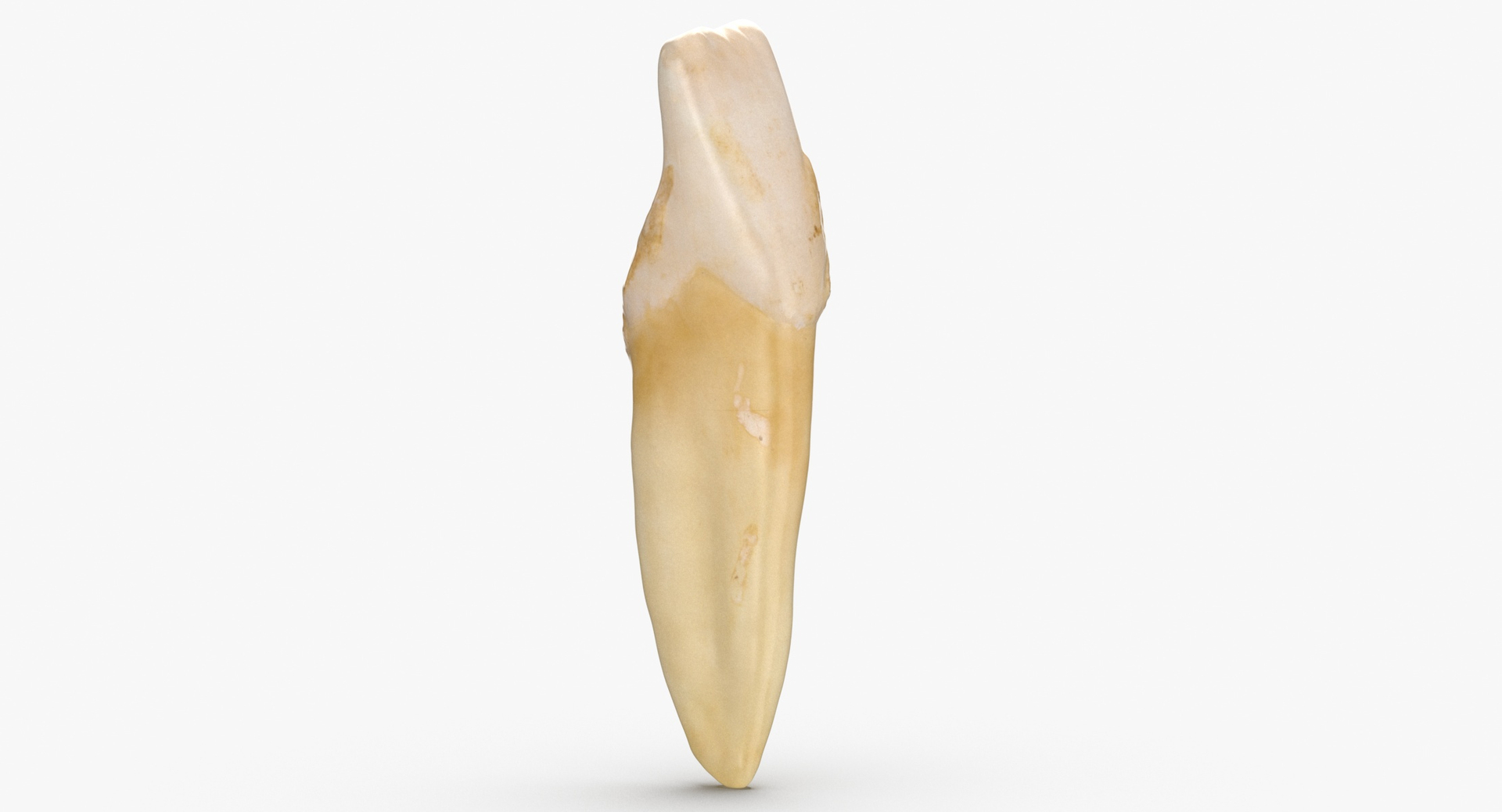 3D model Human Lower Jaw Incisors Clean and Broken Collection - 6 ...