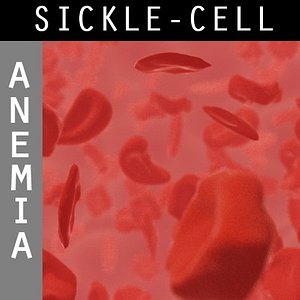 3D Anemia Models | TurboSquid