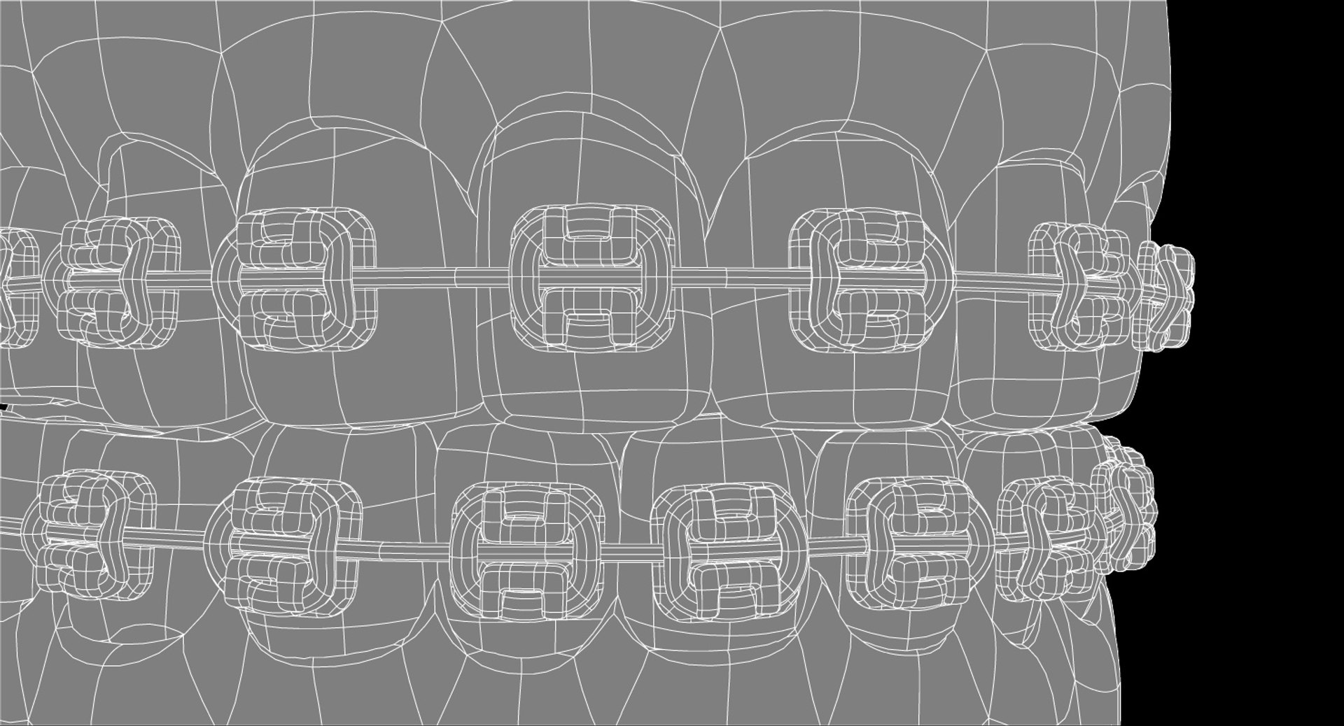 Teeth Braces 3d Model
