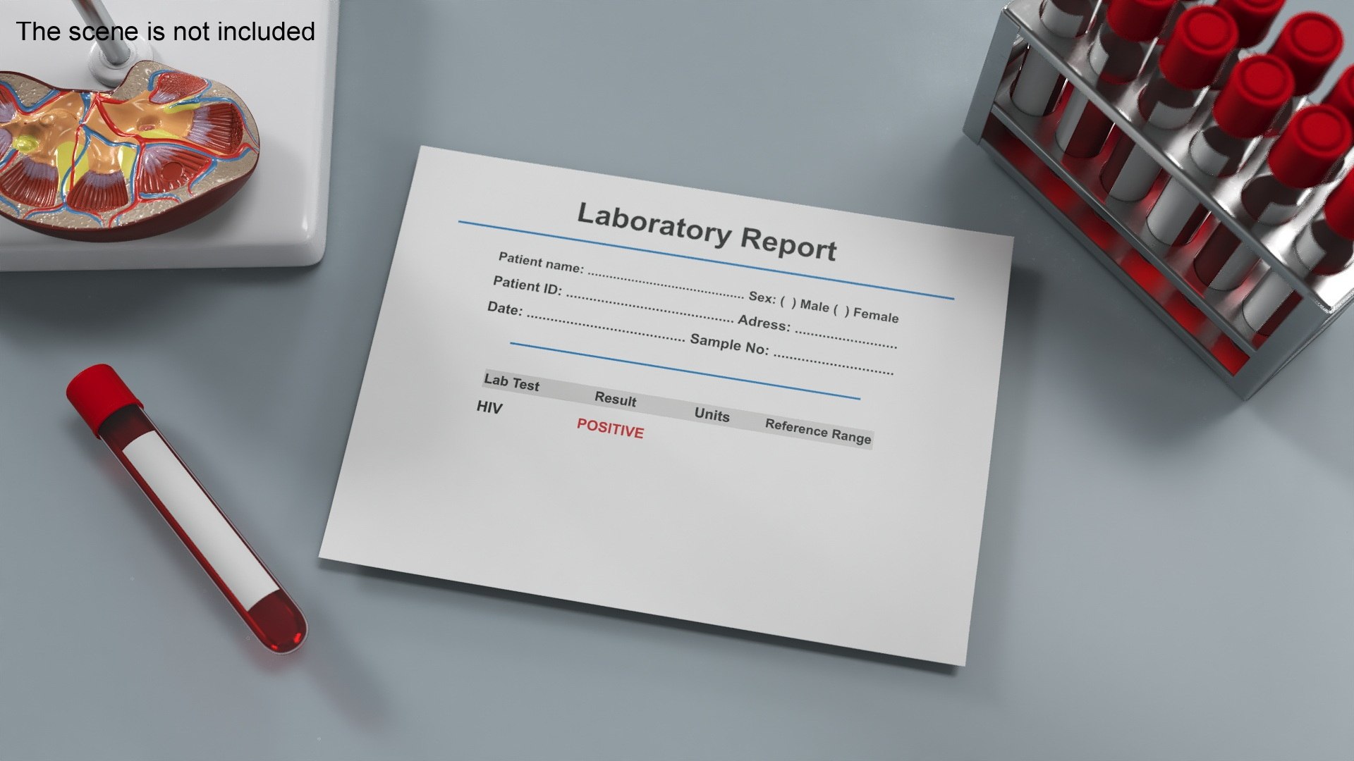 Laboratory HIV Report Form Negative 3D Model - TurboSquid 2395906
