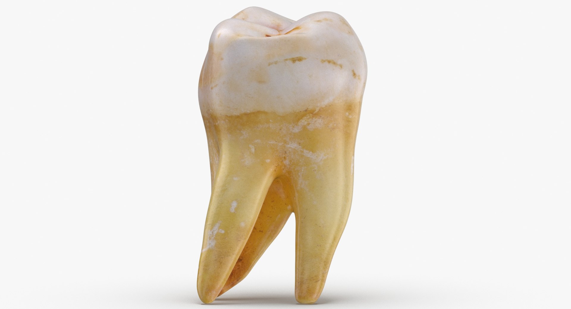 Molar Upper Jaw Right 3D - TurboSquid 1512982