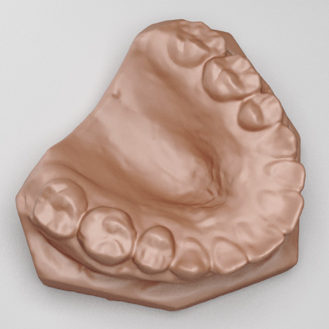 Dental Cast 3ds