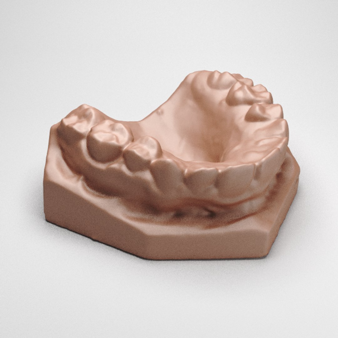 Dental Cast 3ds
