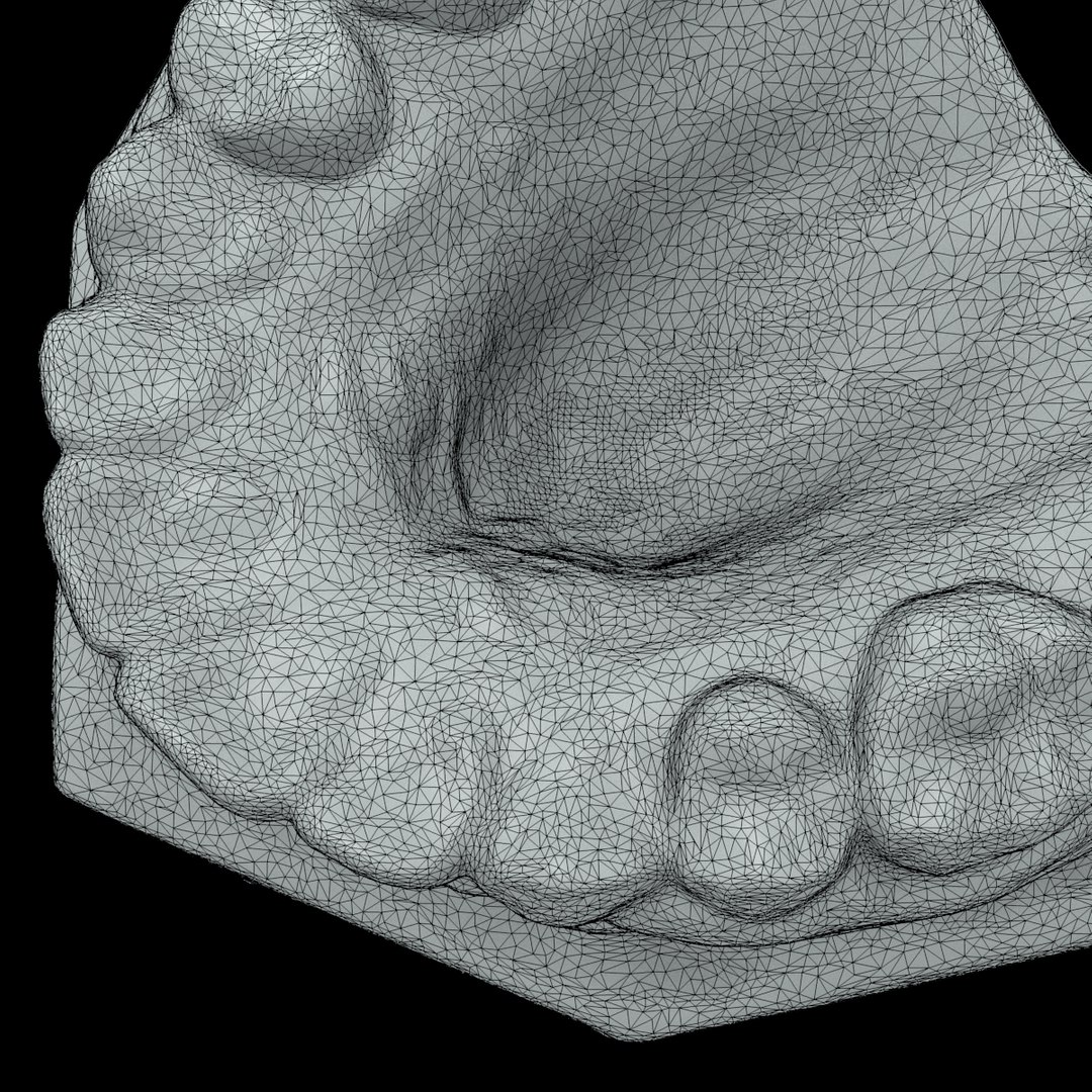 Dental Cast 3ds