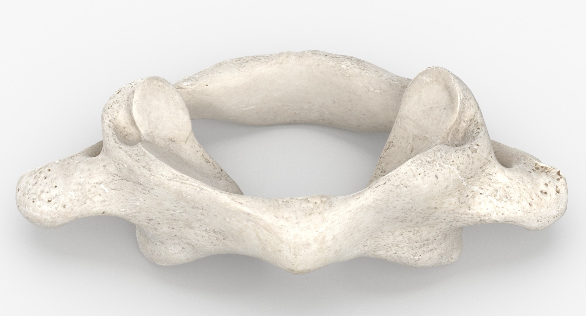 Cervical Vertebrae C1 Atlas 3D Model - TurboSquid 1600279