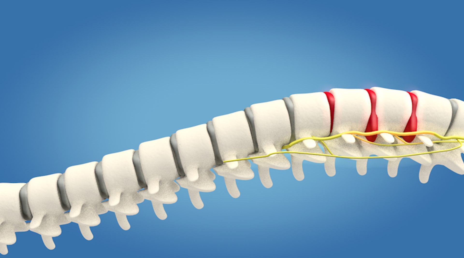 3D Spine Compression Nerve Model - TurboSquid 1196483