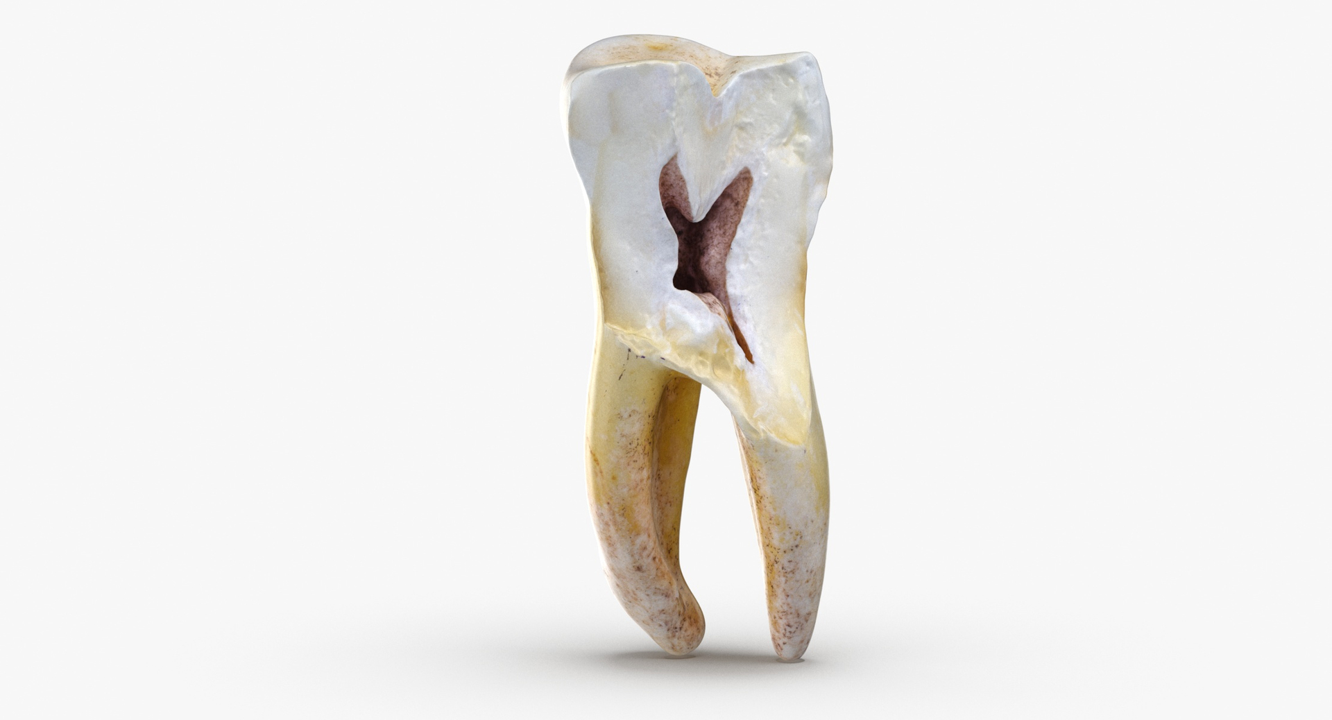 3D Model Molar Lower Left Jaw - TurboSquid 1509053