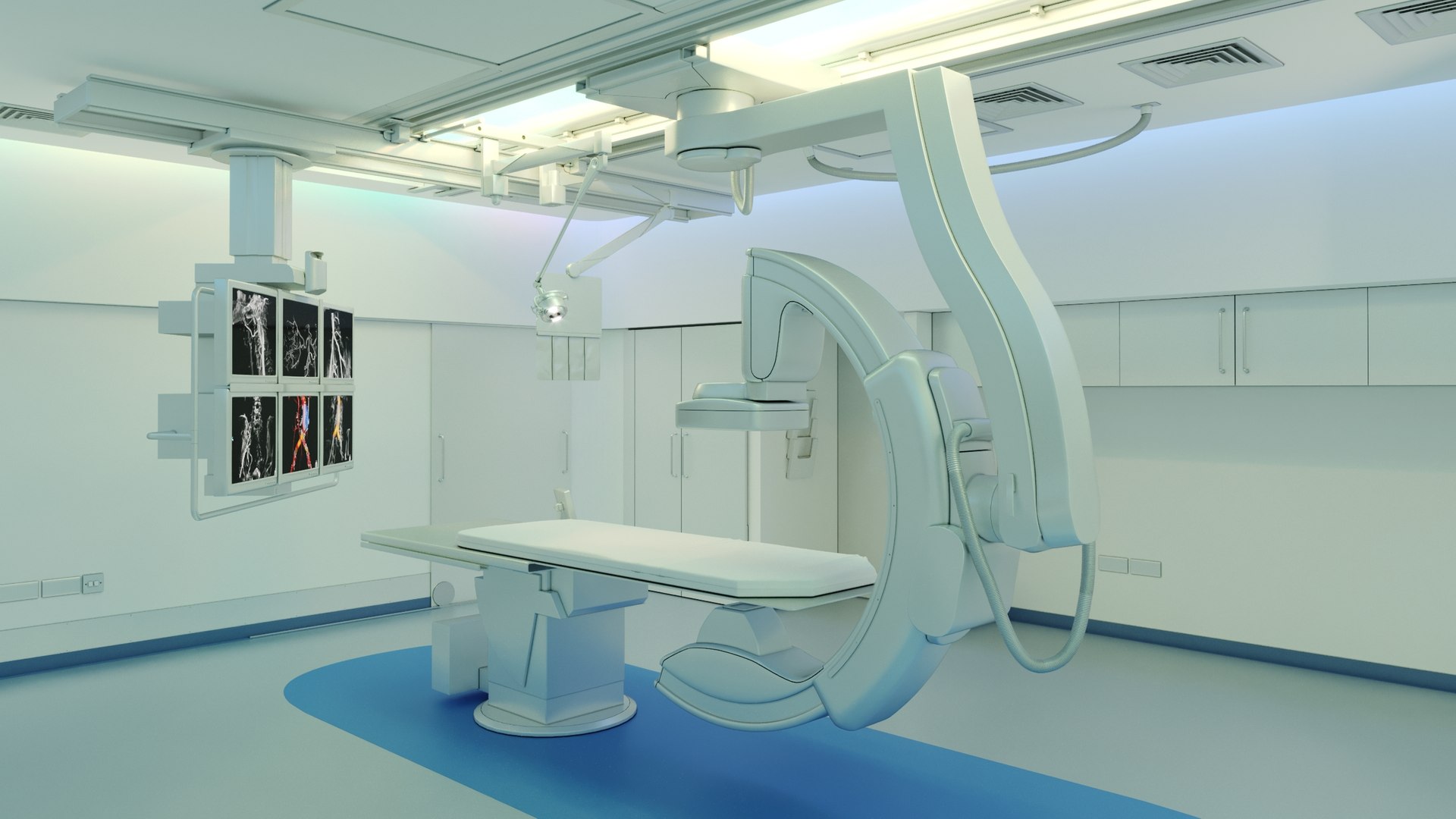 Philips Allura Xper Fd20 3d Model