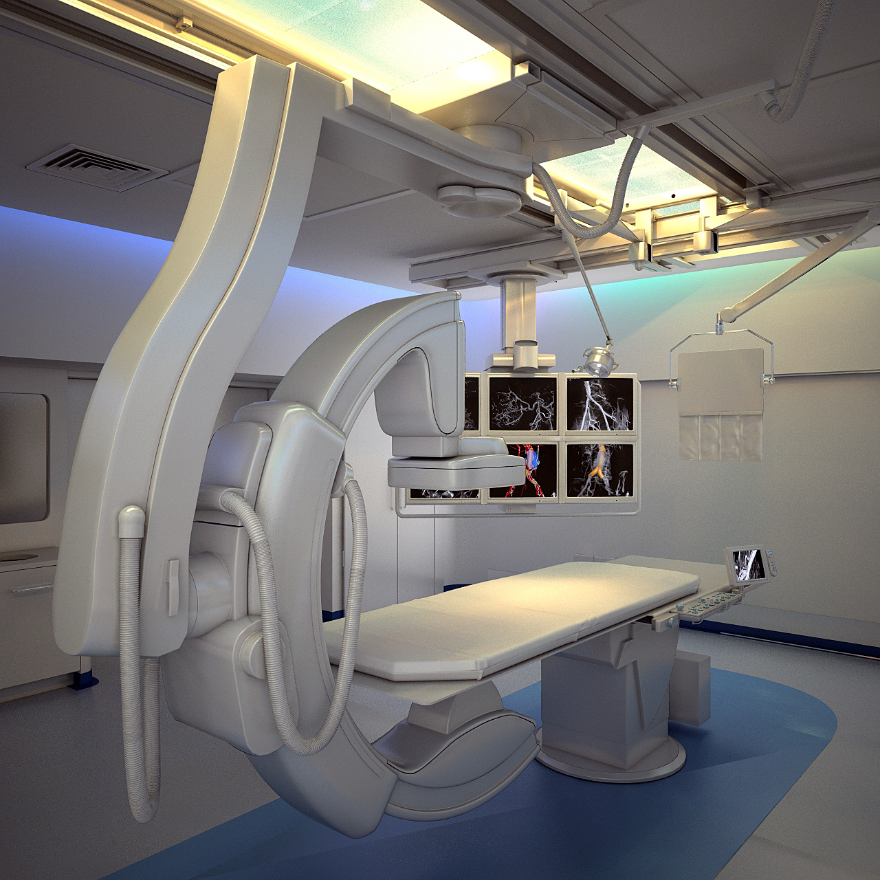 philips allura xper fd20 3d model