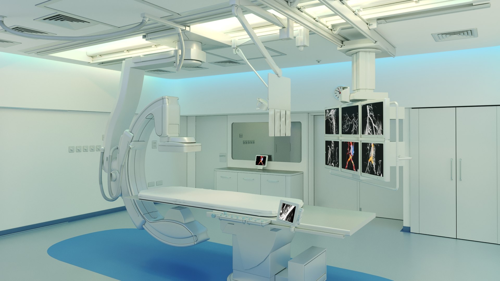 Philips Allura Xper Fd20 3d Model