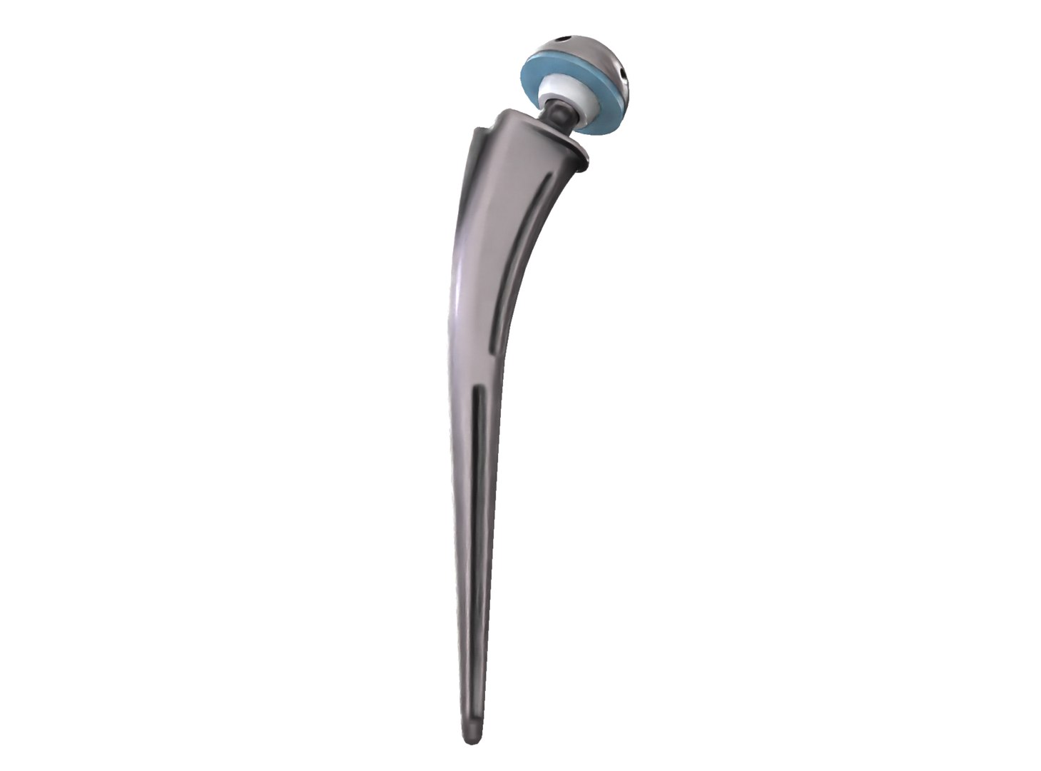 Hip Replacement Implant 3D Model - TurboSquid 1507423