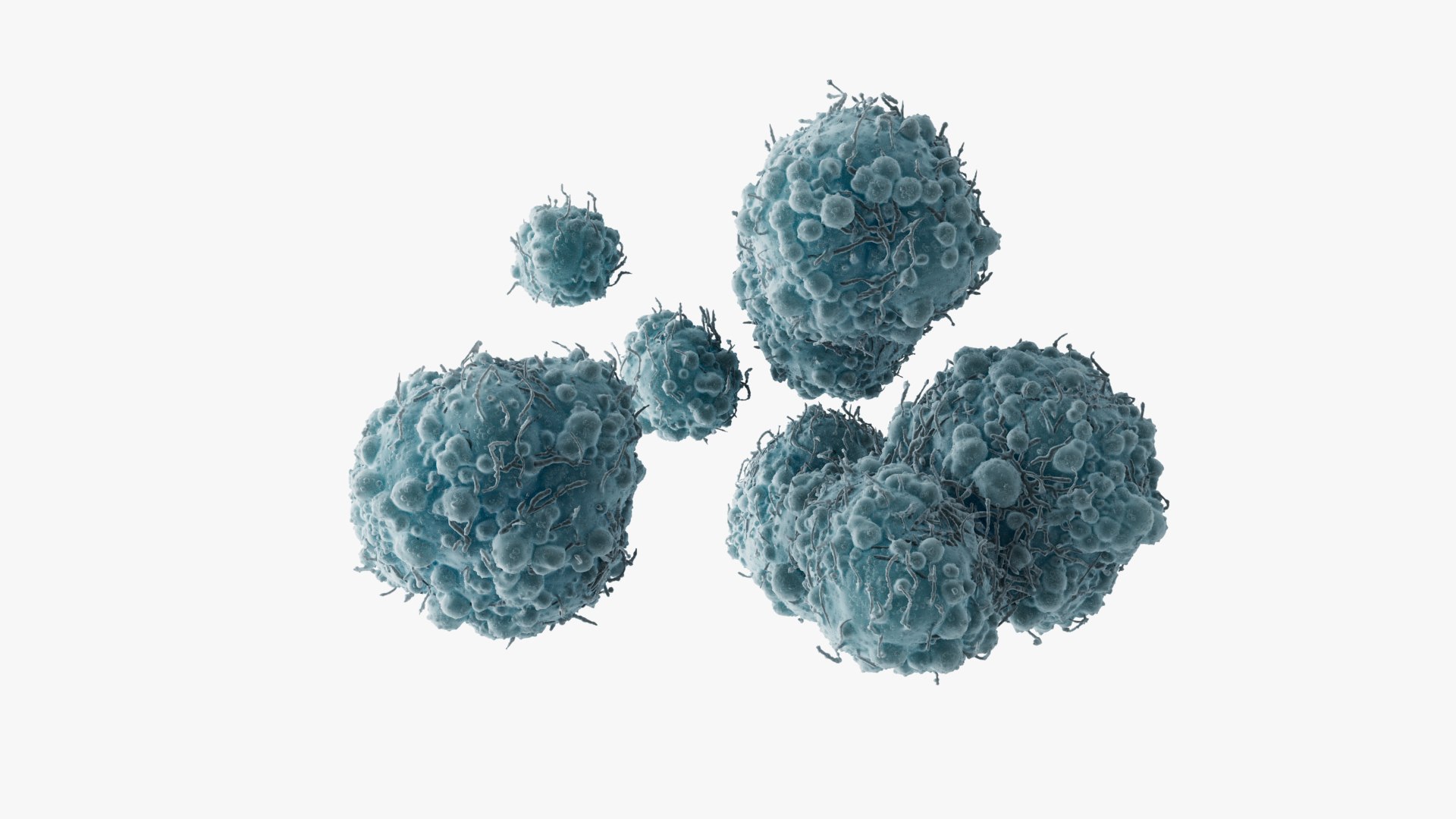 Cancer Cells Brain 2 3D Model - TurboSquid 2225315
