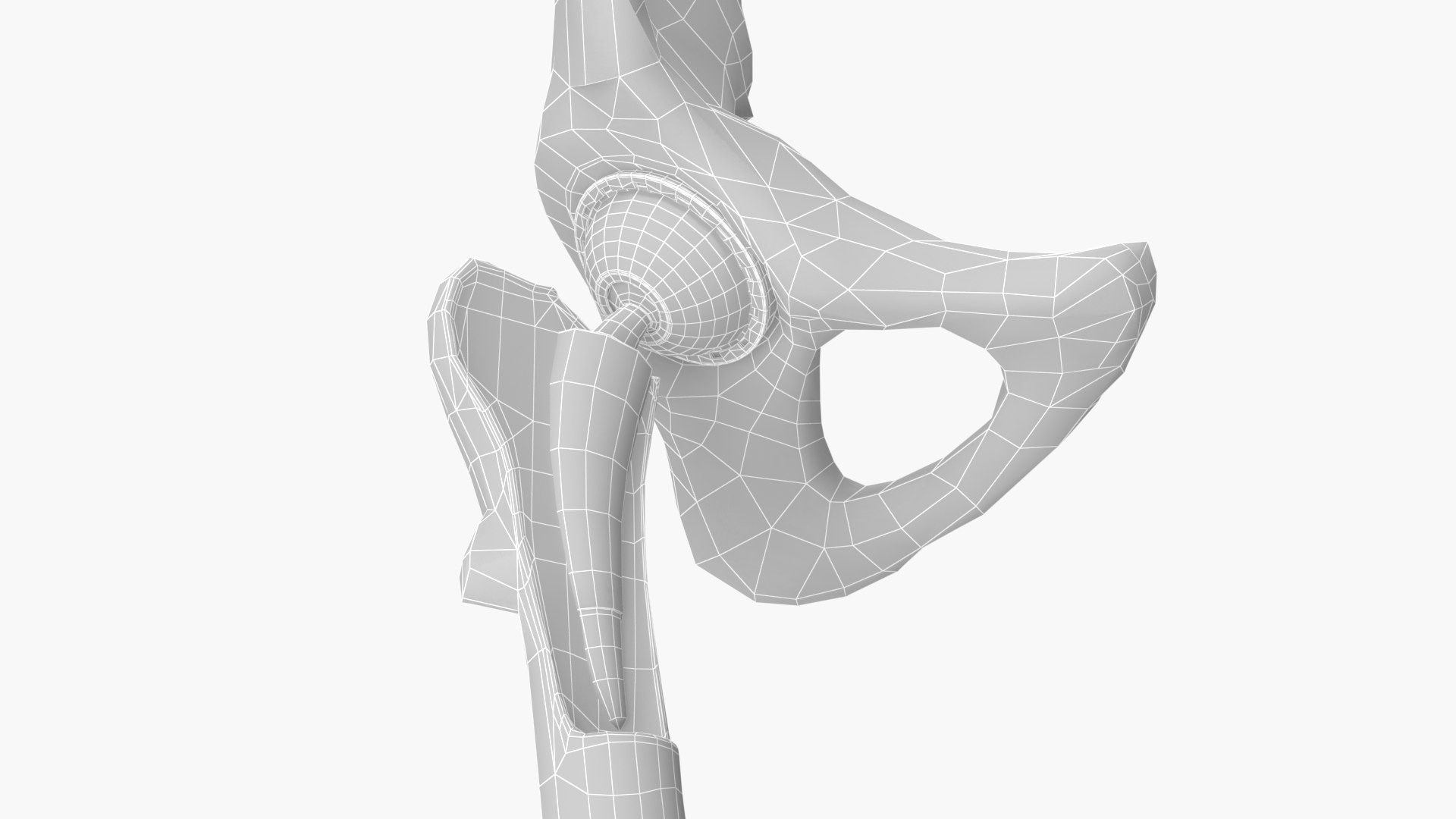 3D Hip Bone Replacement Surgery V01 - TurboSquid 1744808
