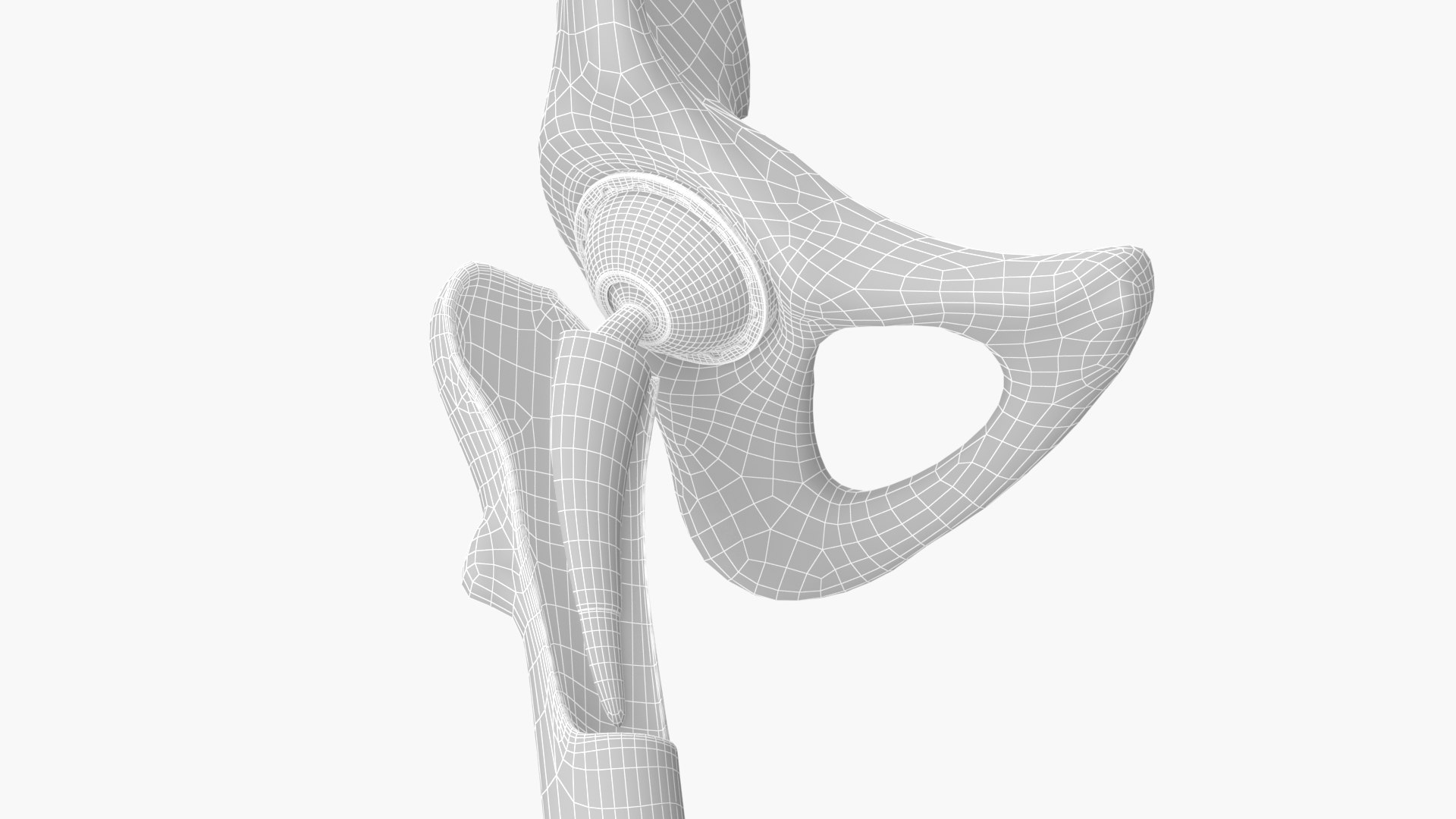 3D Hip Bone Replacement Surgery V01 - TurboSquid 1744808