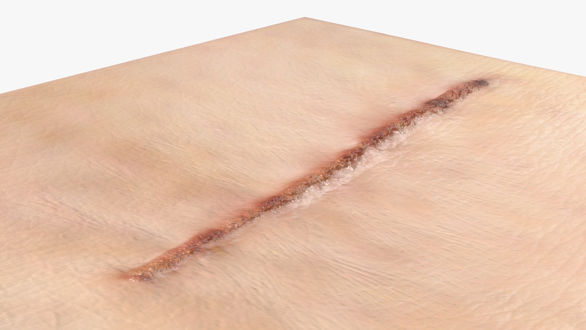 Medical Suture Closed On Skin 3D - TurboSquid 2161381