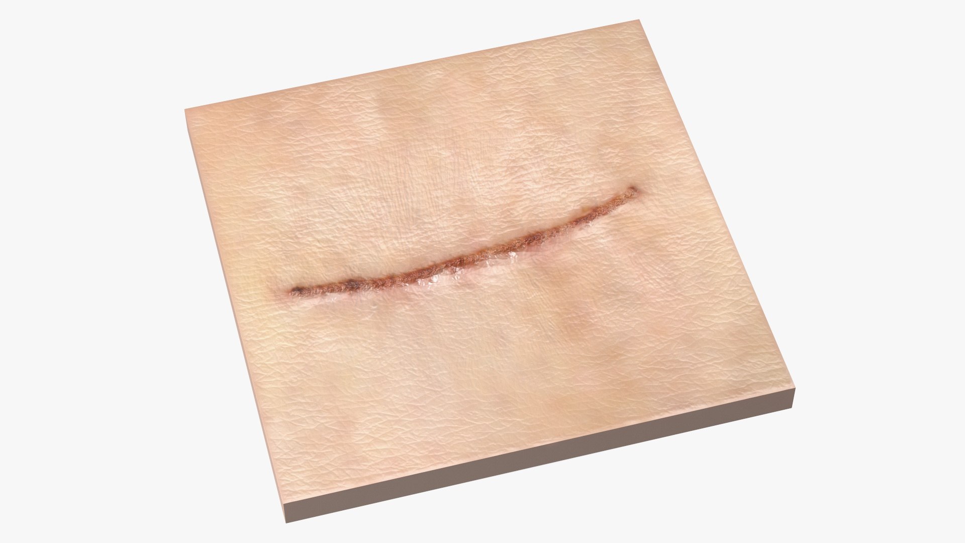 Medical Suture Closed On Skin 3D - TurboSquid 2161381