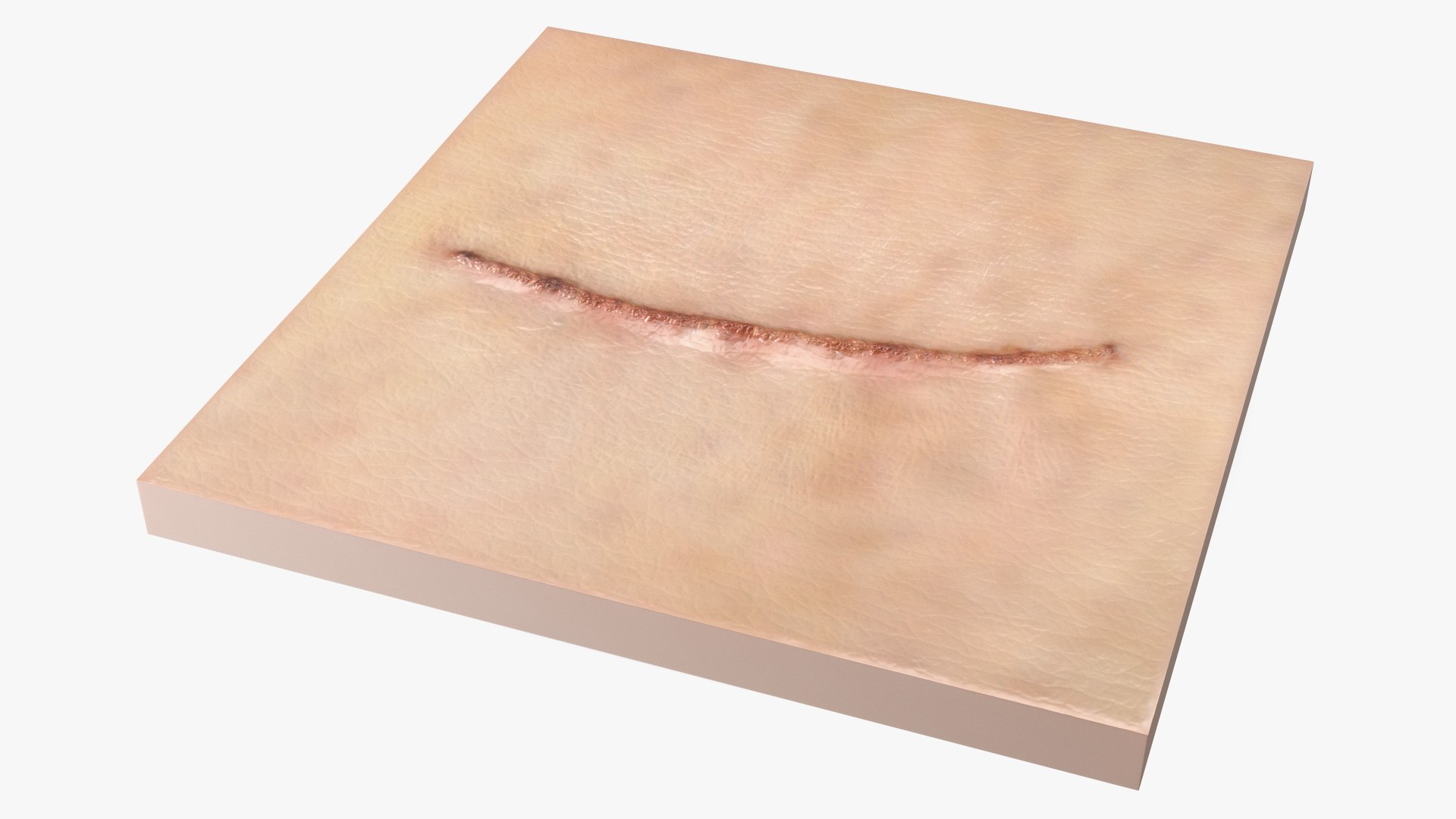 Medical Suture Closed On Skin 3D - TurboSquid 2161381
