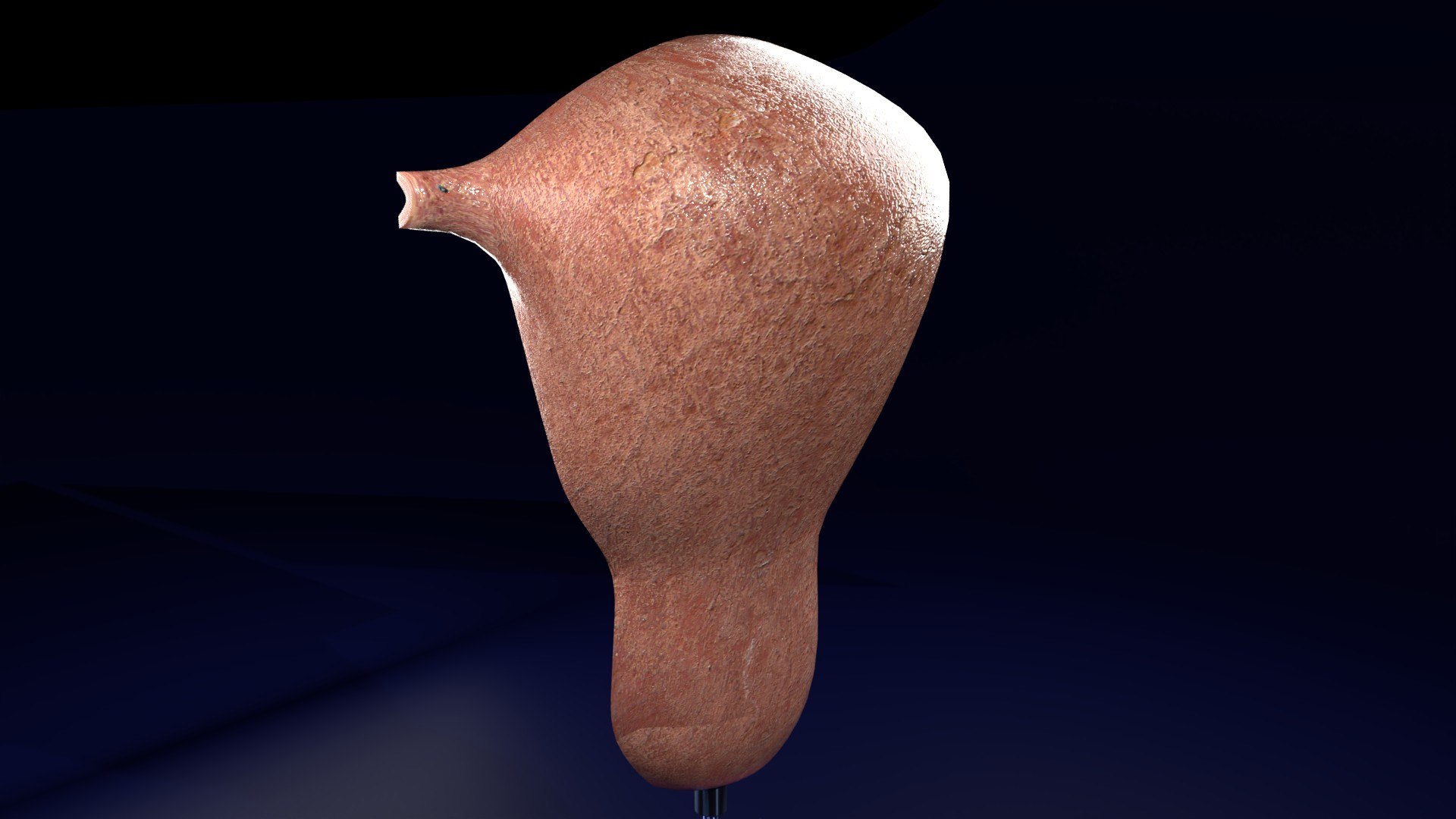 3D Endometrial Polyp Electrocautery Model - TurboSquid 2442265