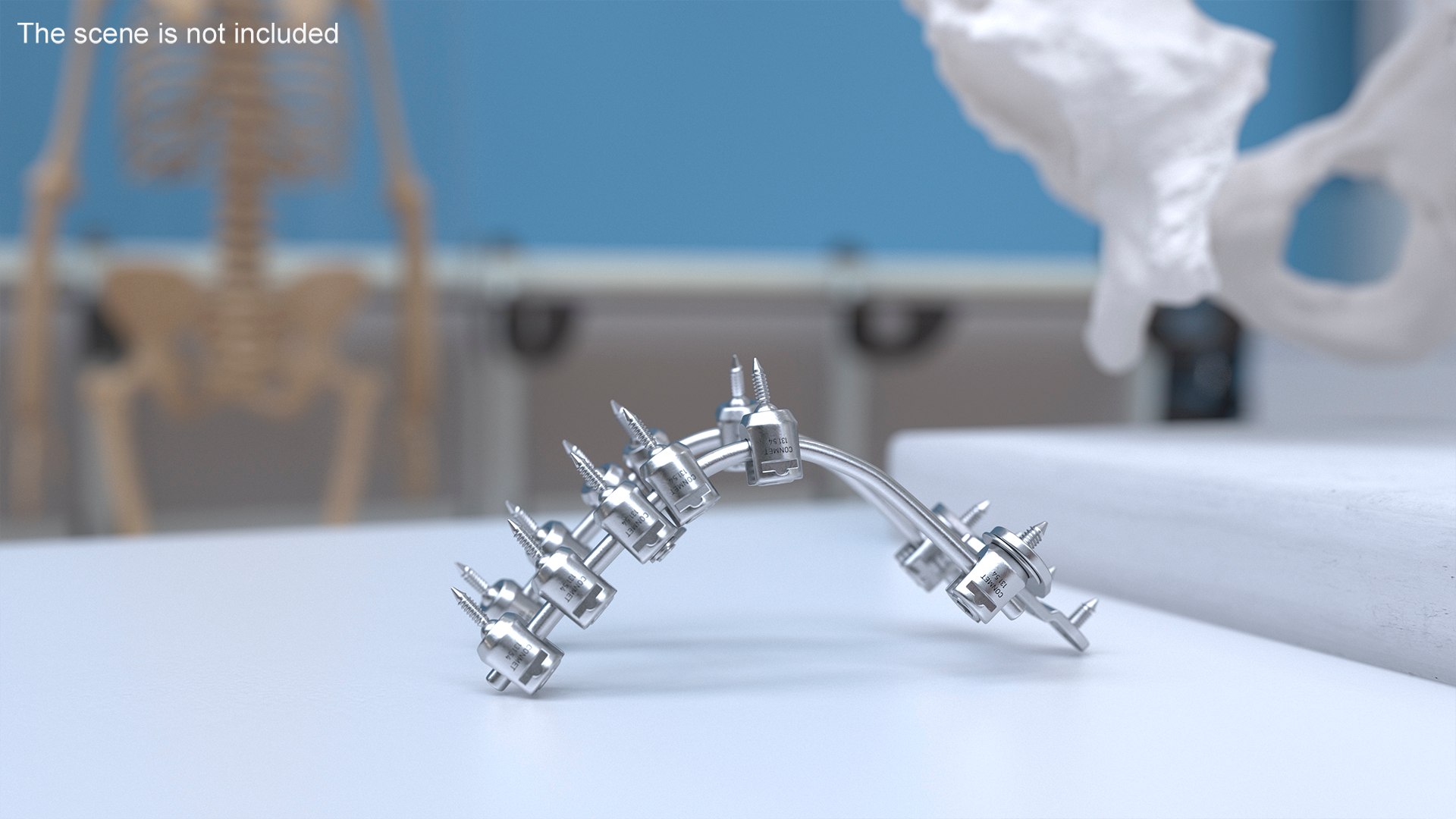3D Posterior Cervical Spine Fixation System - TurboSquid 2205567