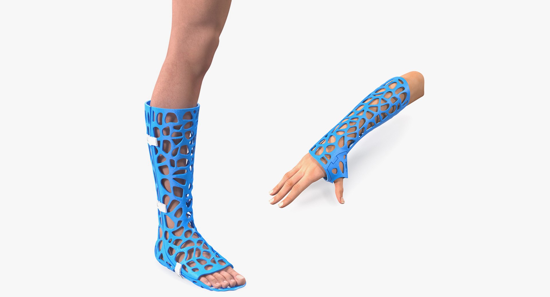 3D-Printed Orthopedic Casts On Limbs Collection 3D - TurboSquid 1920148
