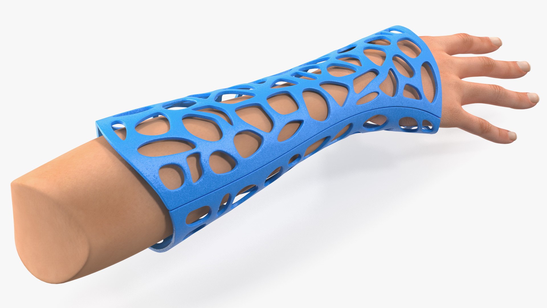 3D-Printed Orthopedic Casts On Limbs Collection 3D - TurboSquid 1920148