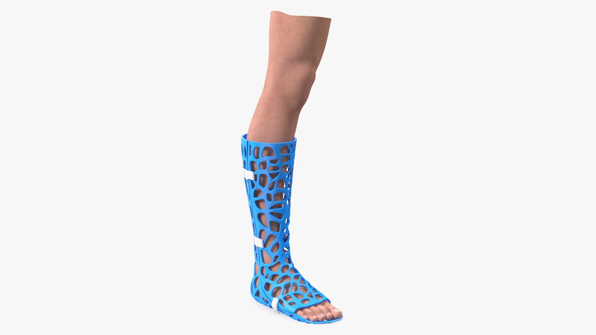3D-Printed Orthopedic Casts On Limbs Collection 3D - TurboSquid 1920148